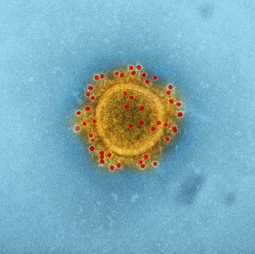 Measures Against the Spread of the Corona-Virus | Fritz Haber Institute ... Measures Against the Spread of the Corona-Virus | Fritz Haber Institute ...